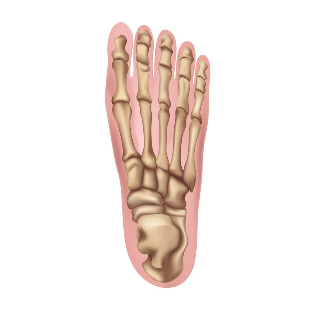 PLANTAR FASİİT NEDİR?TEDAVİSİ NASILDIR? - Malatya Evde Fizik Tedavi ...